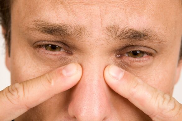 Get Rid Clogged Pores on Nose, Squeeze, Clean, Remedies, Causes of ...