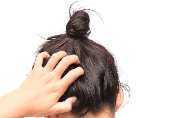 Smelly Scalp Causes, Symptoms, Treatments, Home Remedies for Scalp Odor ...